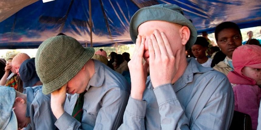 Albinism association advocates for inclusion of skin cancer in health ...